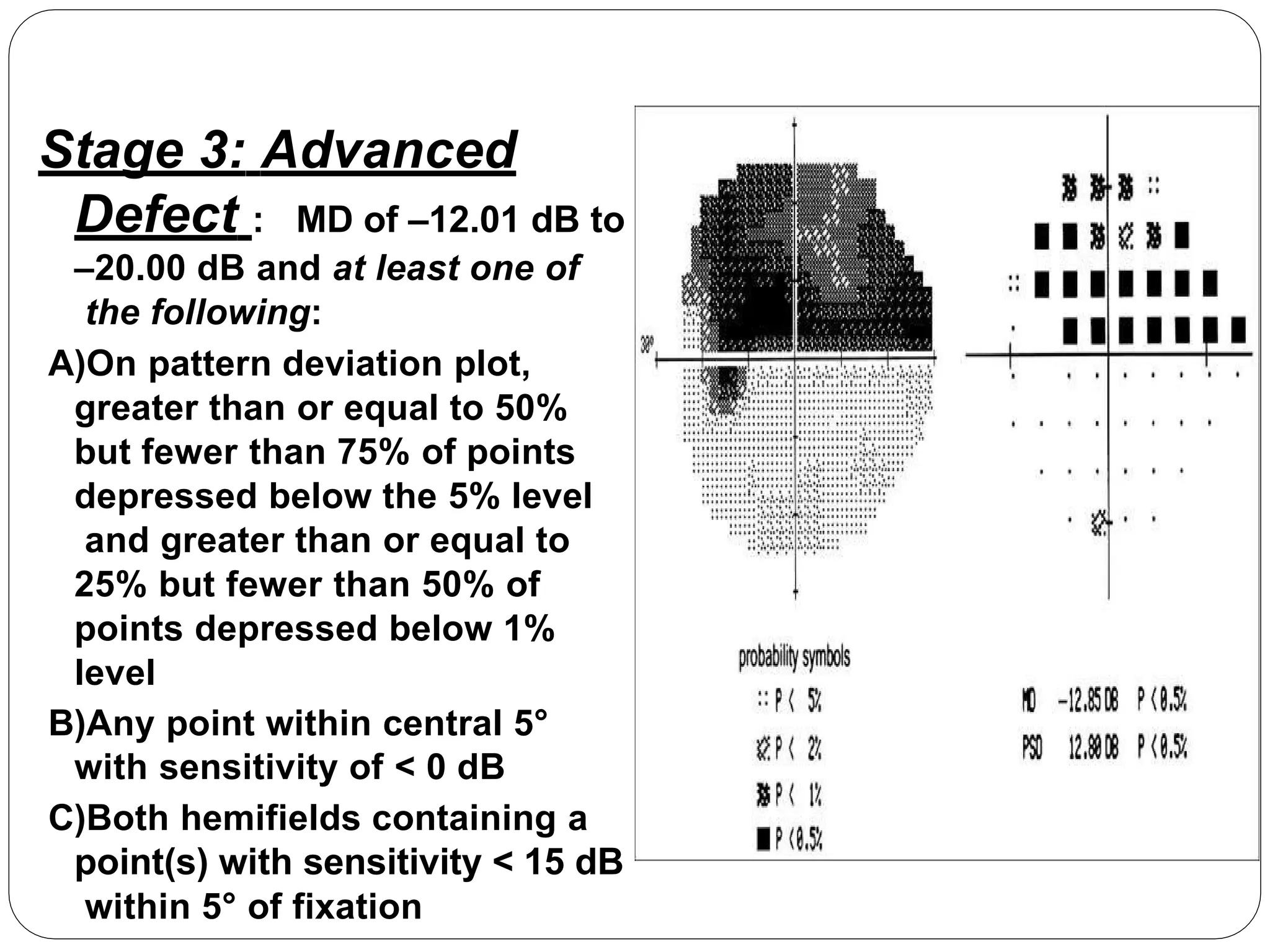 automated perimetry/ Humphrey's visual field.pptx