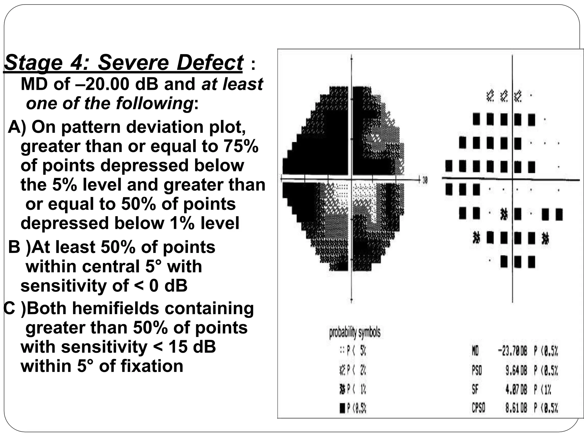 automated perimetry/ Humphrey's visual field.pptx