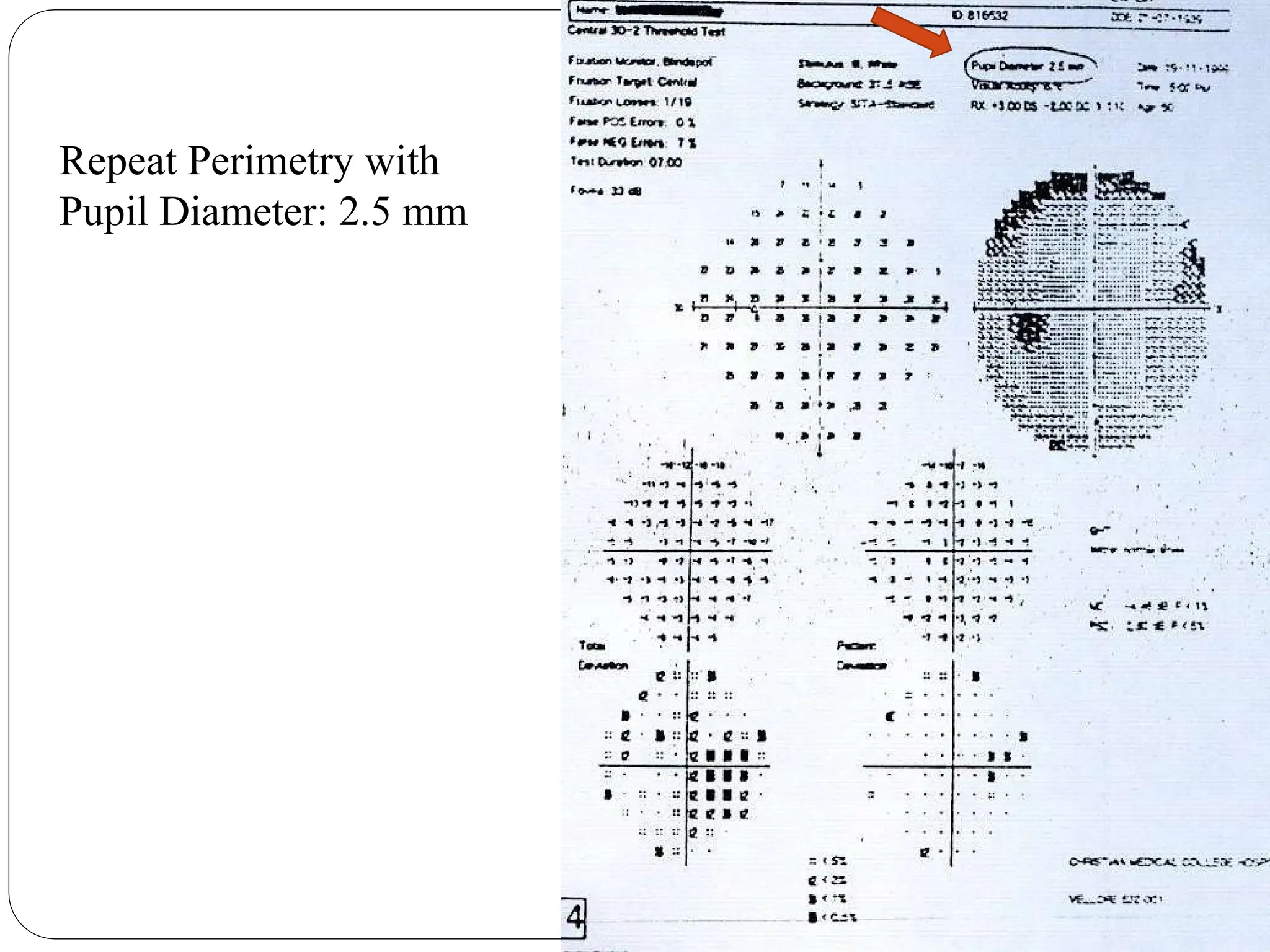 automated perimetry/ Humphrey's visual field.pptx