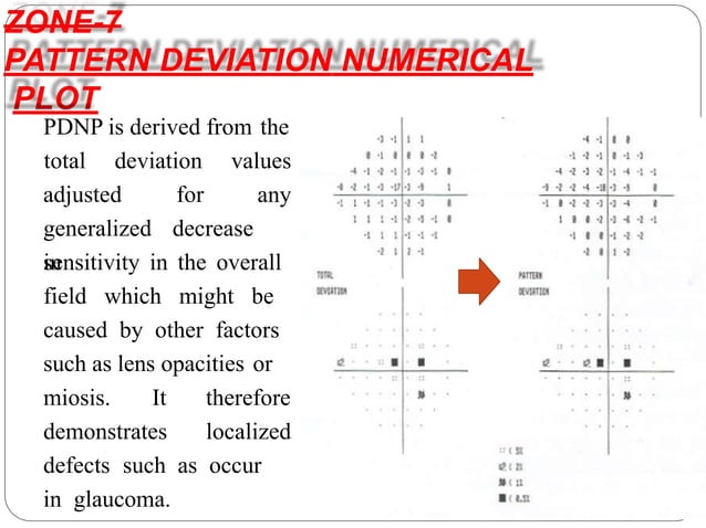 automated perimetry/ Humphrey's visual field.pptx