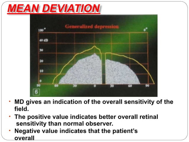 automated perimetry/ Humphrey's visual field.pptx