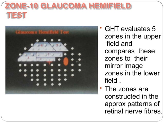 automated perimetry/ Humphrey's visual field.pptx