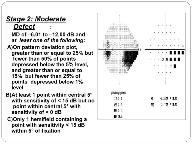 automated perimetry/ Humphrey's visual field.pptx