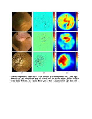 IEEE 2014 MATLAB IMAGE PROCESSING PROJECTS Automated polyp detection in colon capsule endoscopy ...