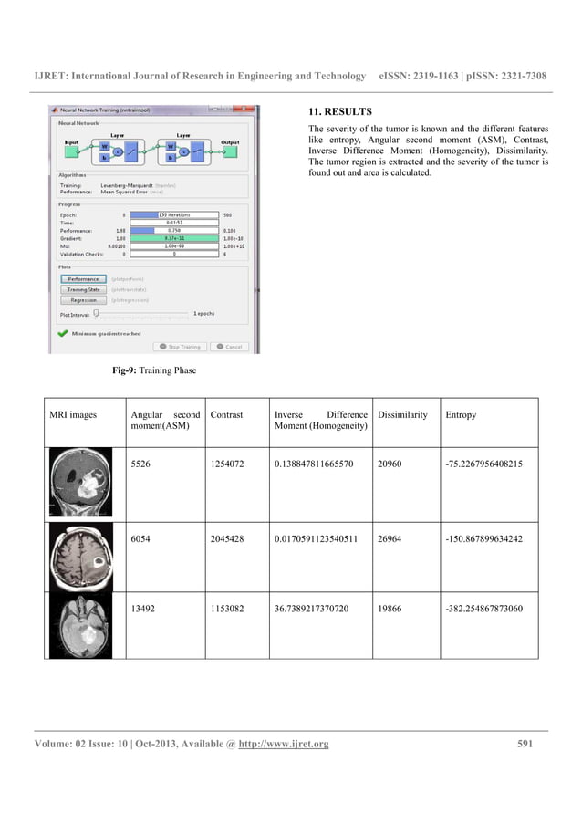 Automatic detection and severity analysis of brain | PDF