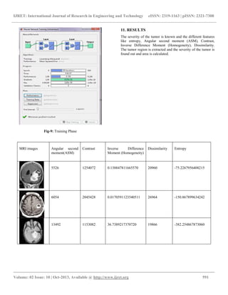Automatic detection and severity analysis of brain tumors using gui in matlab | PDF
