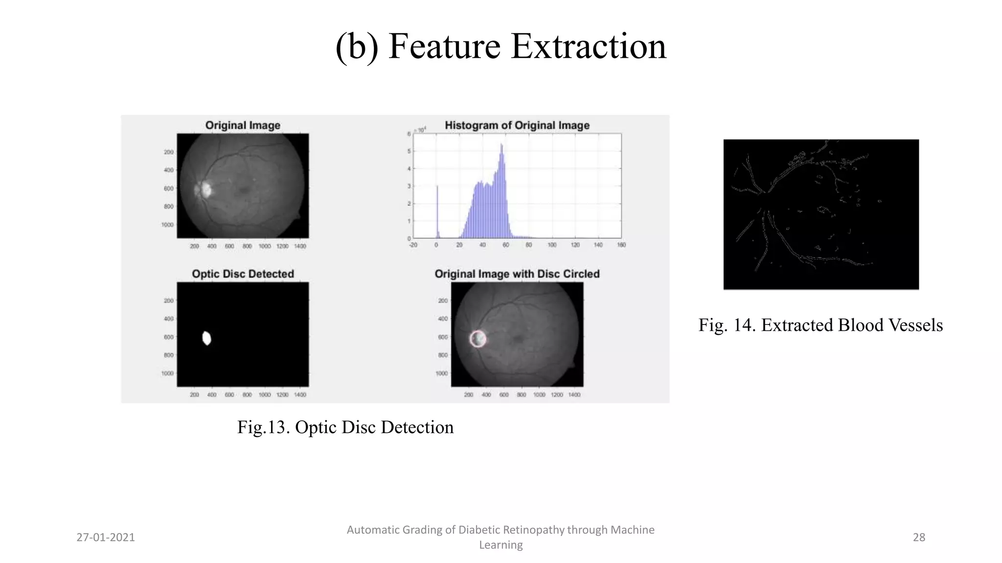 Automatic grading of diabetic retinopathy through machine learning | PPTX
