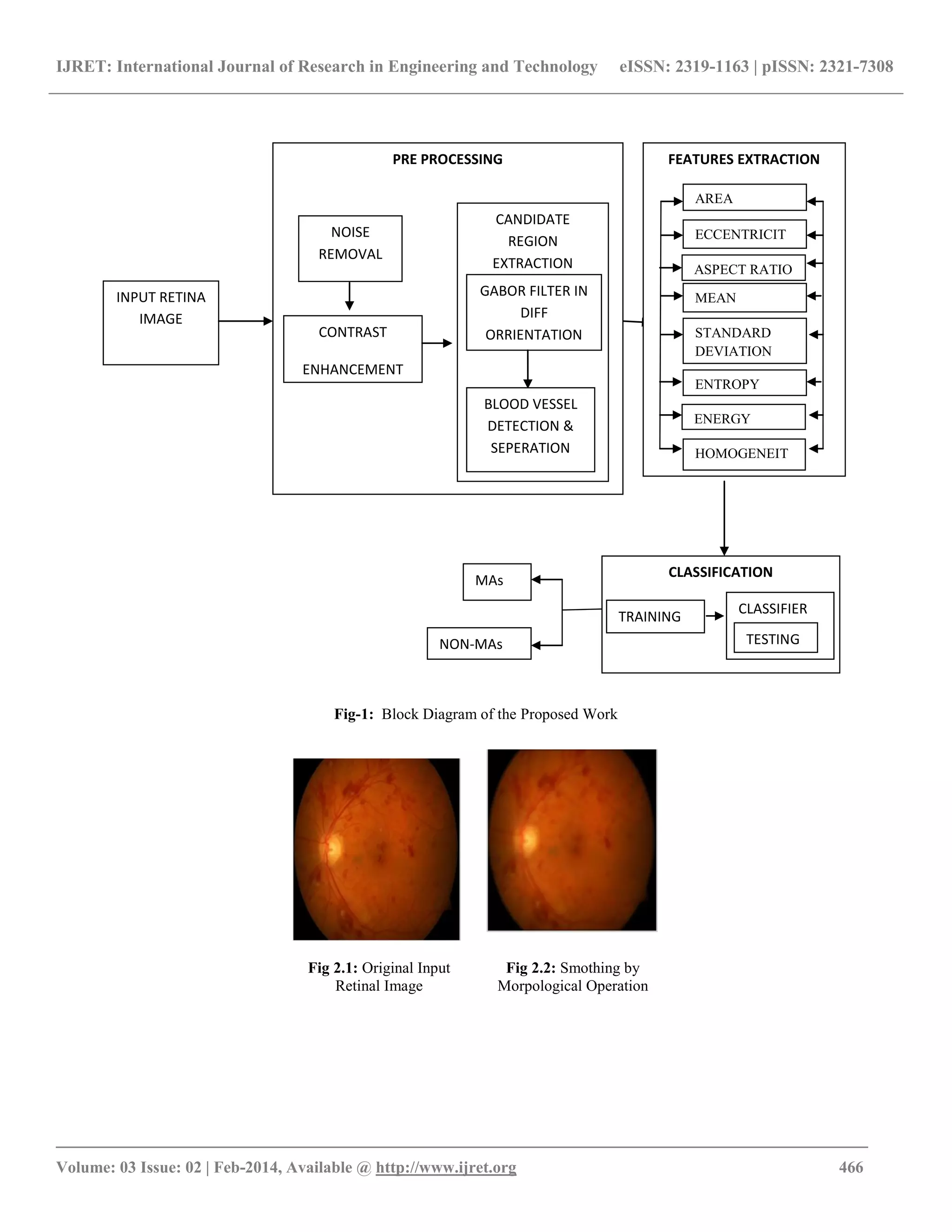 Automatic identification and classification of microaneurysms for detection of diabetic ...
