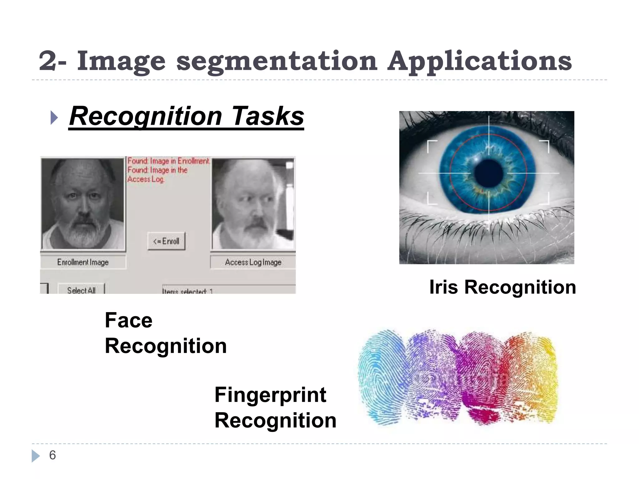 Automatic left ventricle segmentation | PPTX