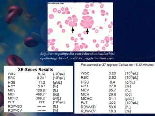Automation in hematology | PPTX