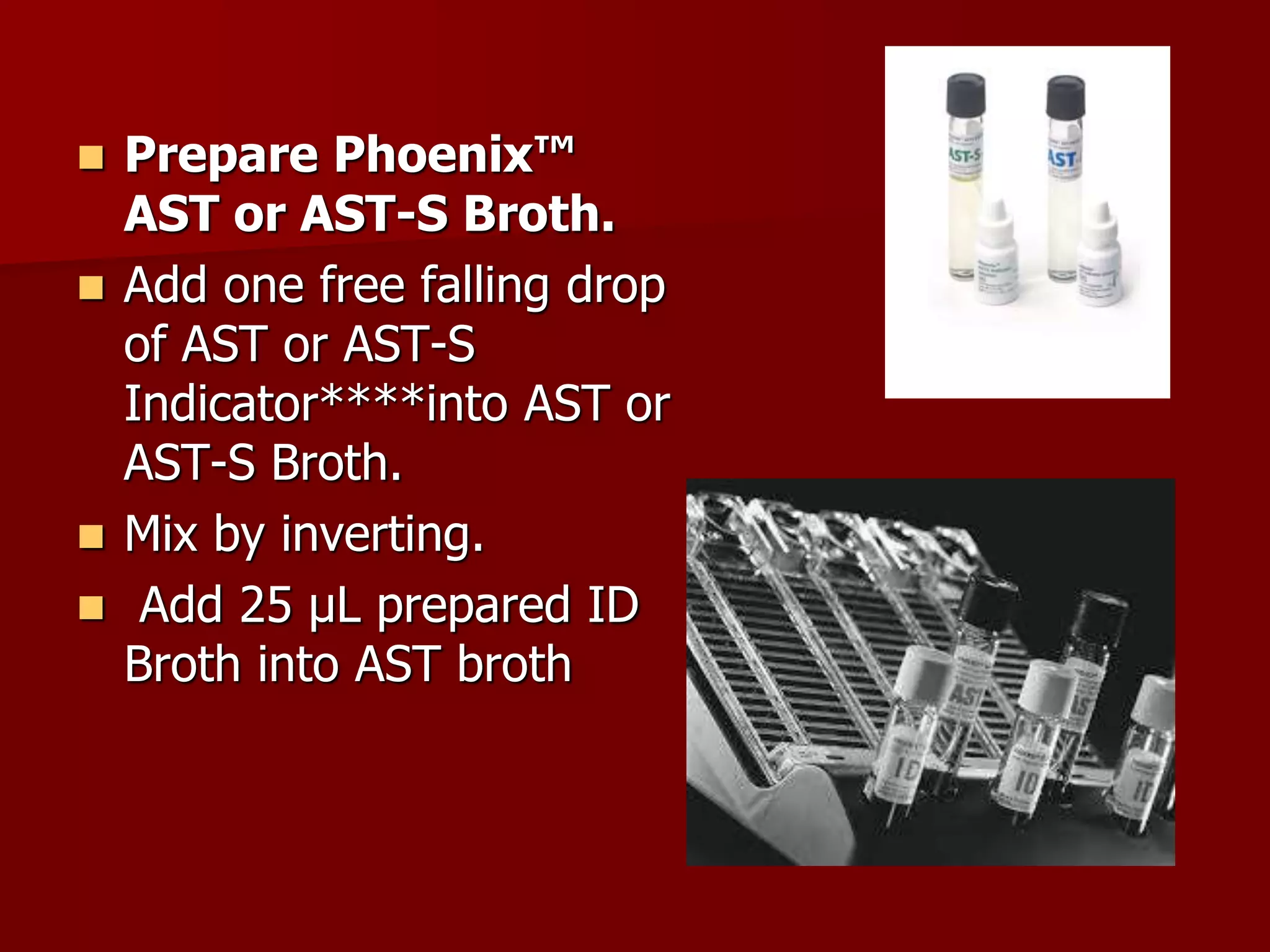 Automation in microbiology, changing concept and defeating challenges ...