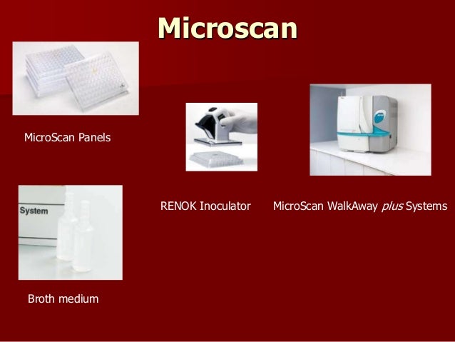 Automation in microbiology, changing concept and defeating challenges