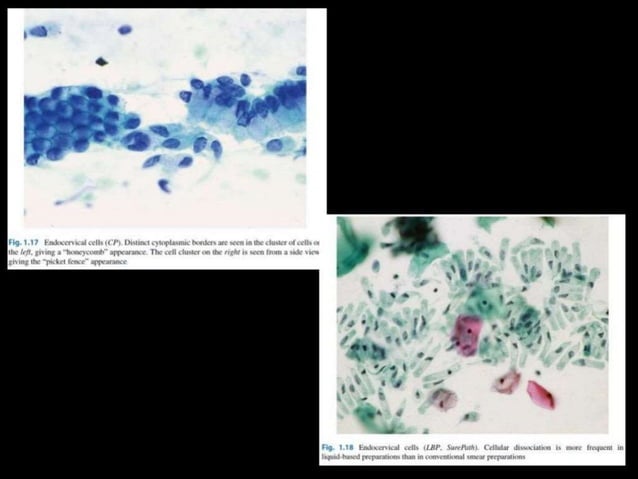 Automation in cytology with methods.pptx