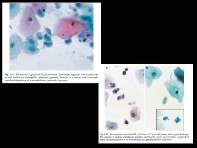 Automation in cytology with methods.pptx