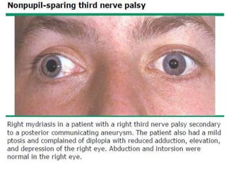 AUTONOMIC EYE PHENOMENA.pptx