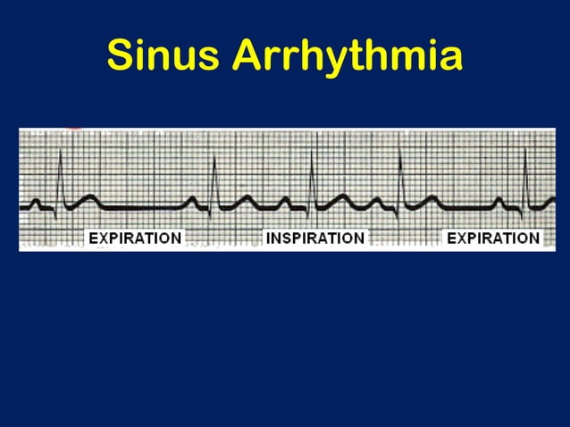 Autonomic function tests | PPT | Lung and Respiratory Health | Diseases ...