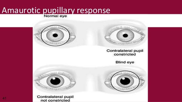 Autonomic innervation of ocular strucures and Pupillary reflexes