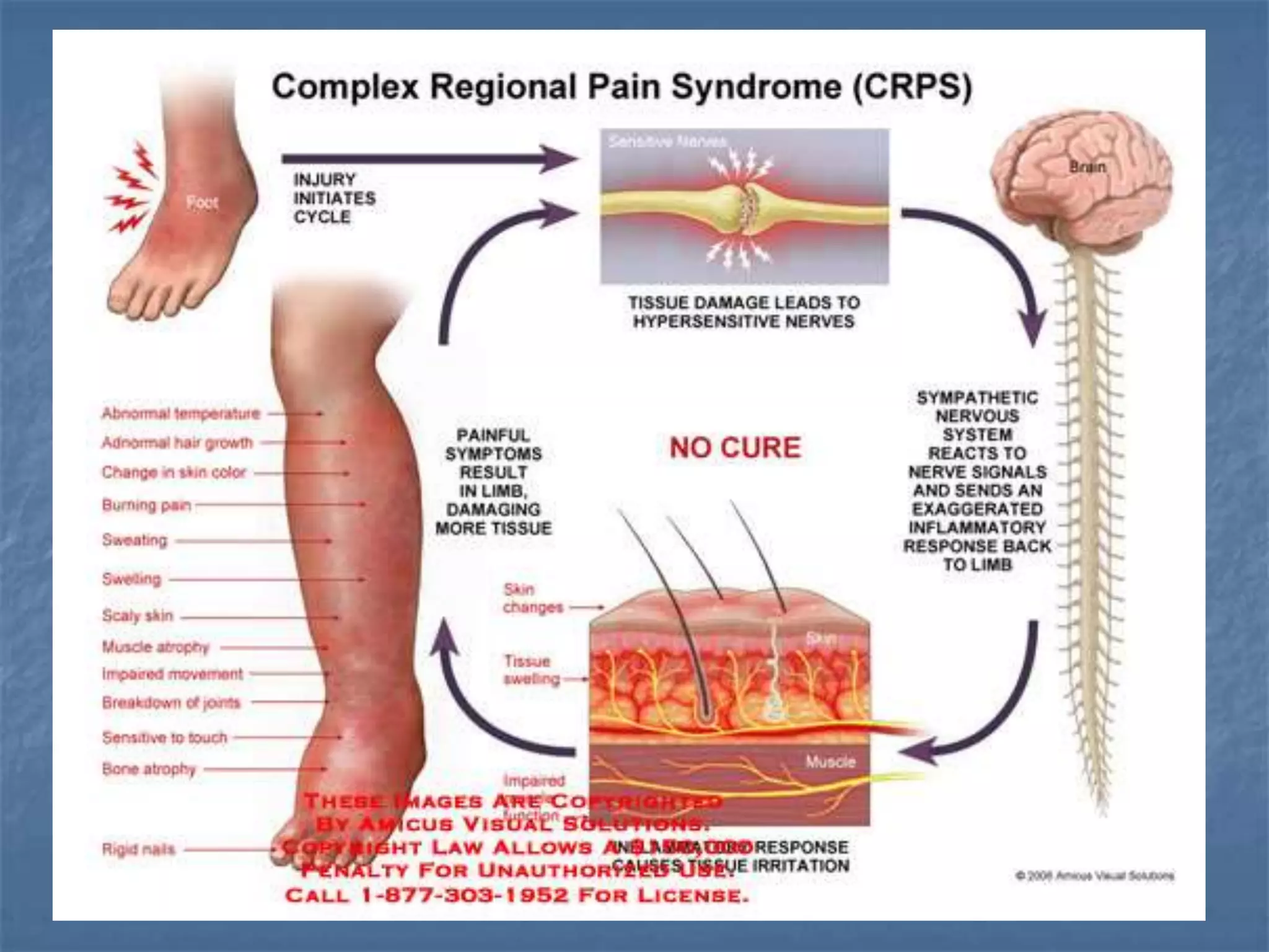Autonomic nervous system dysautonomia.pptx