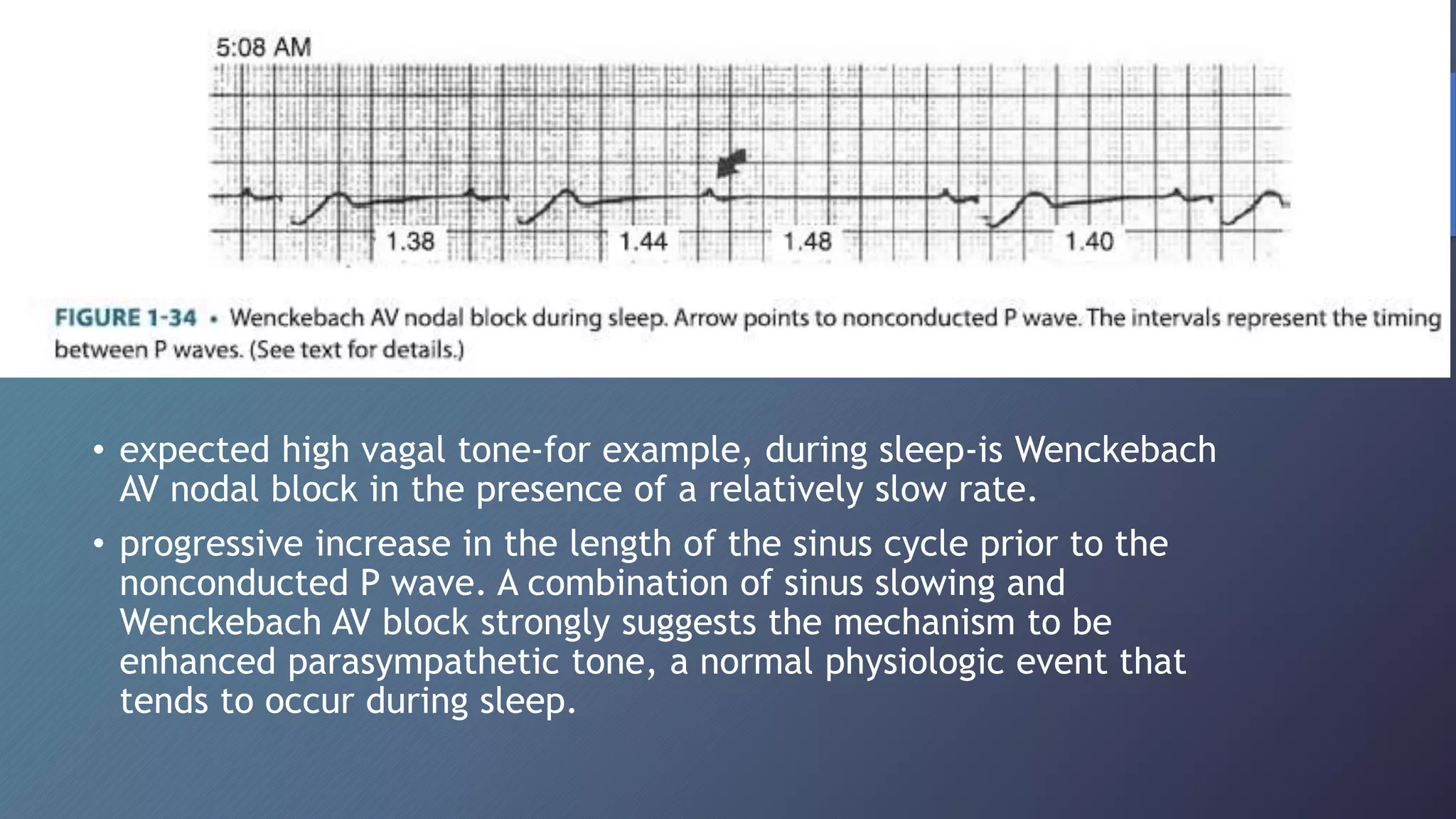 Autonomic Nervous System effects on the heart and.pptx