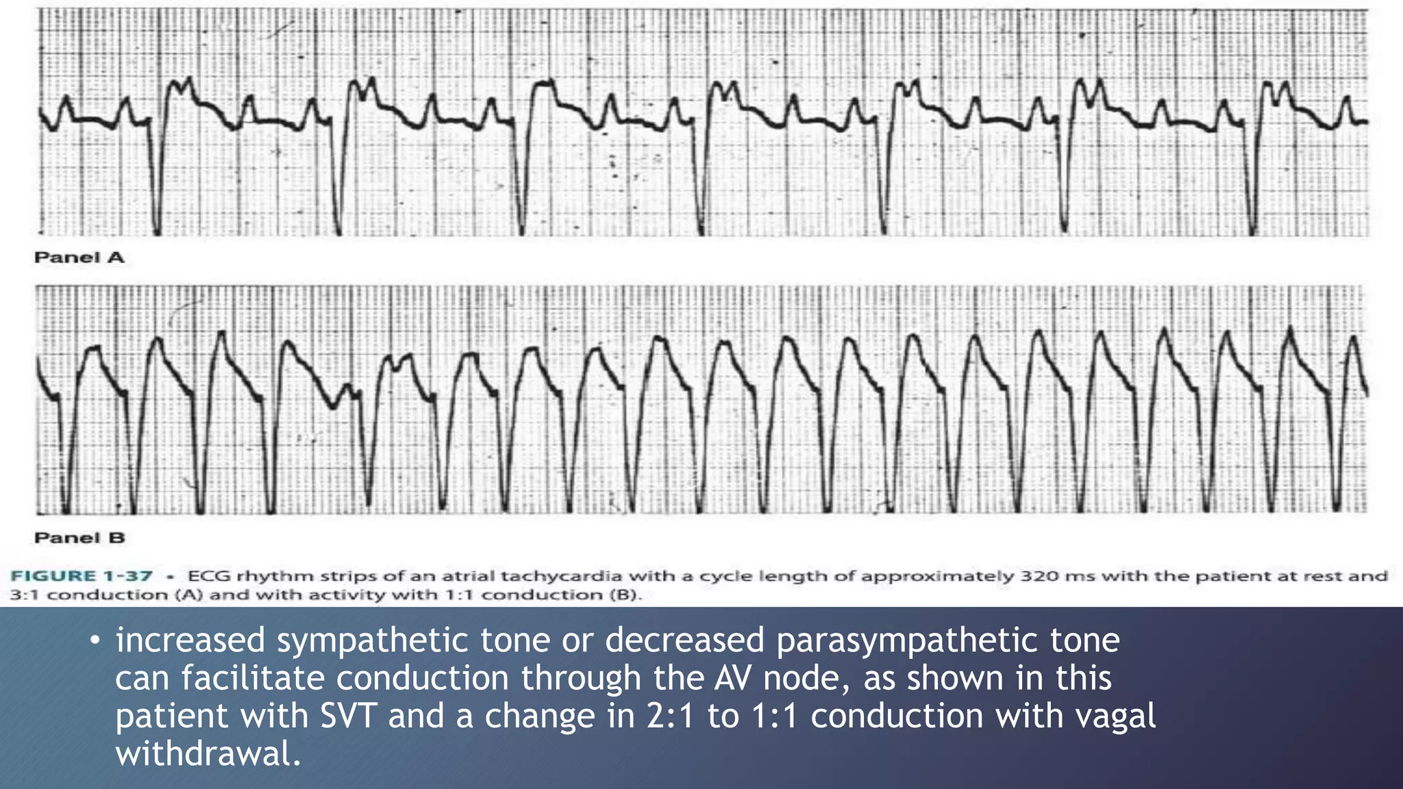 Autonomic Nervous System effects on the heart and.pptx