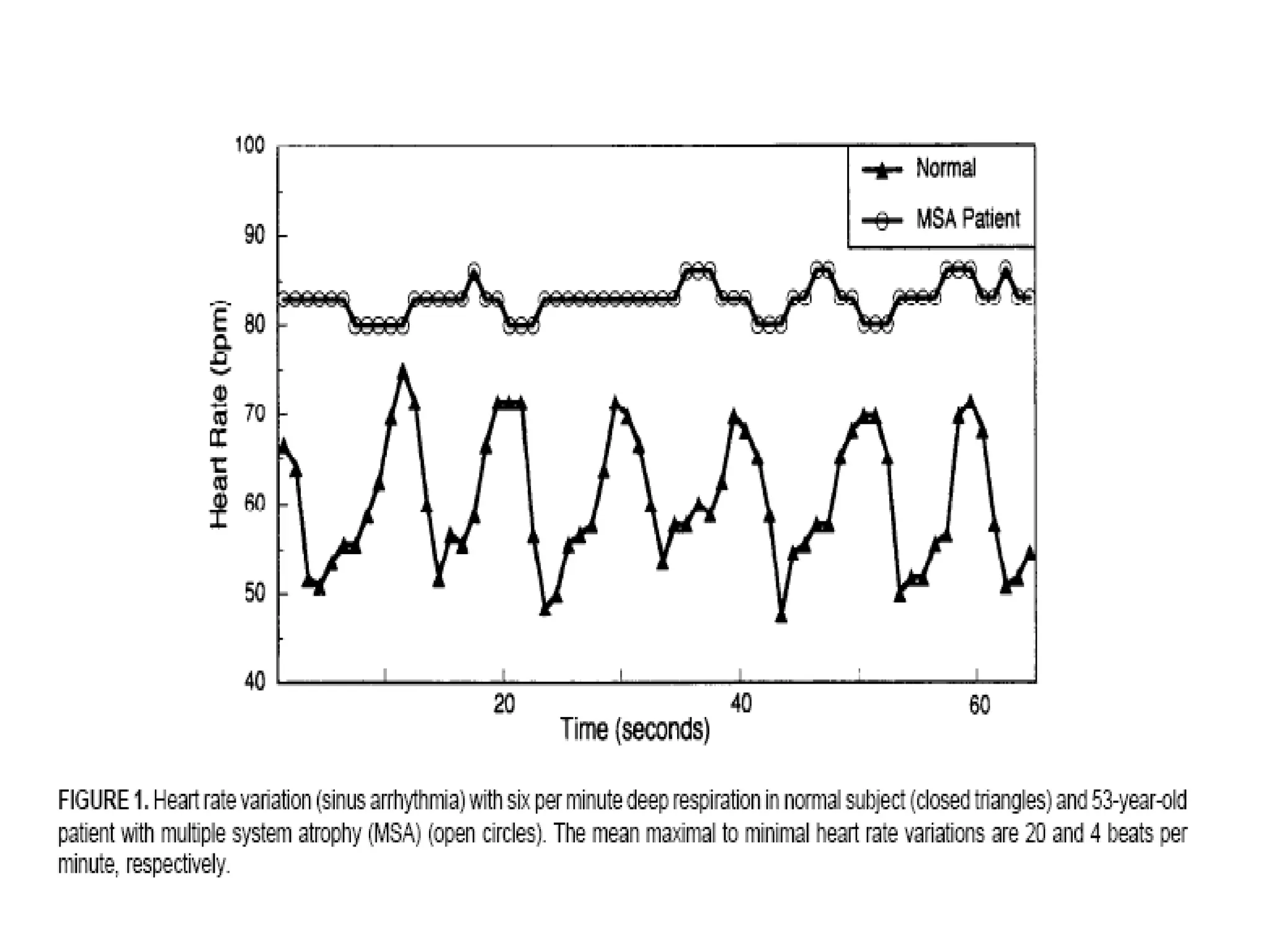 Sympathetic Skin Response (SSR) Testing | PPT