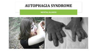 Autophagia syndrome avjot kaur (1) | PDF