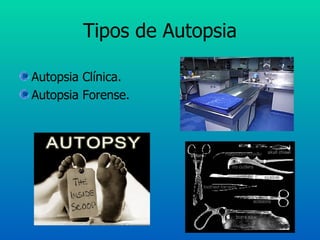AUTOPSIA | PPT