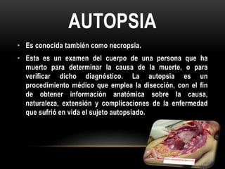 Autopsia