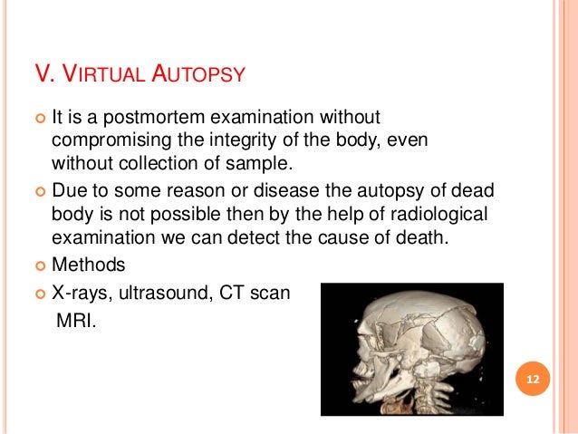 Autopsy