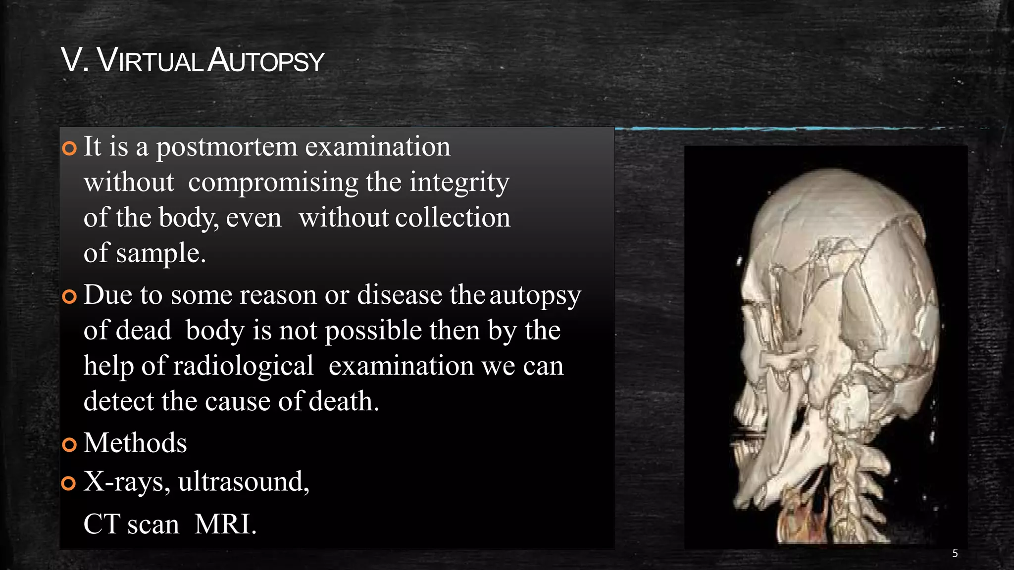 Autopsy | PDF