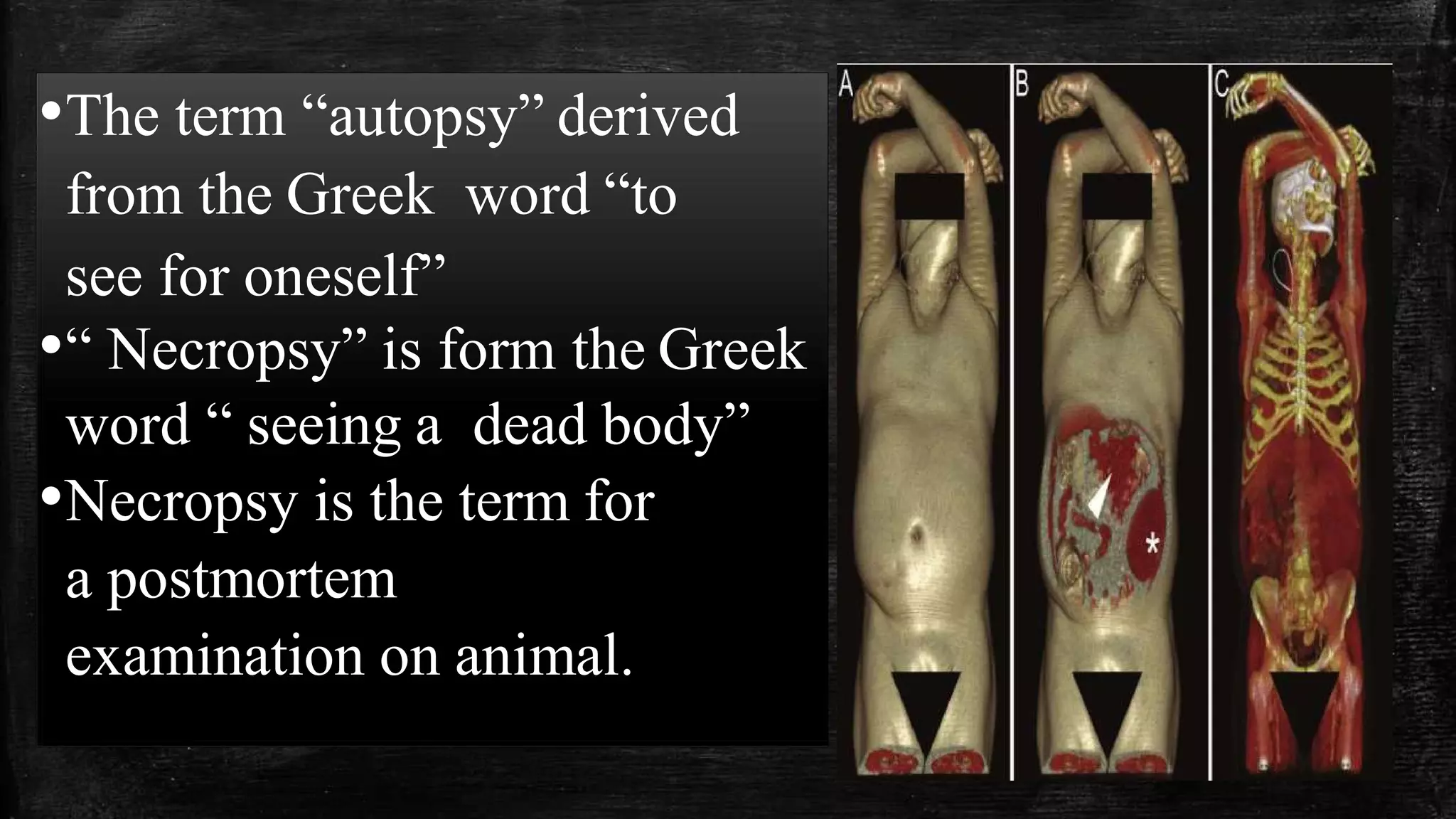 Autopsy | PDF