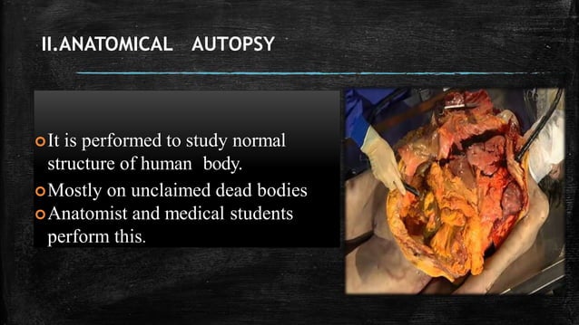 Autopsy | PDF | Death, Injury, or Military Conflict | Sensitive Topics