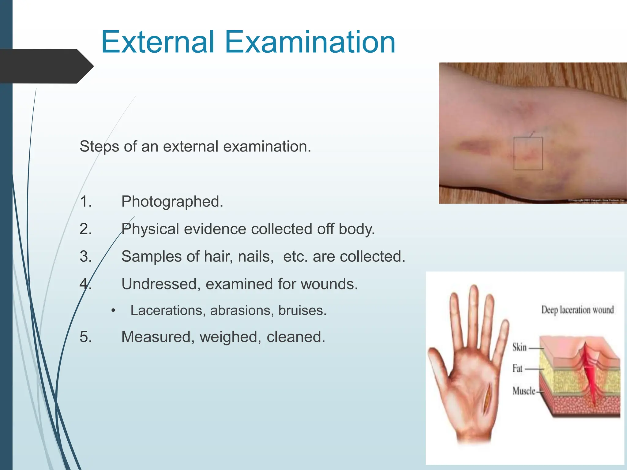 All about Autopsy in forensic medicine .pptx