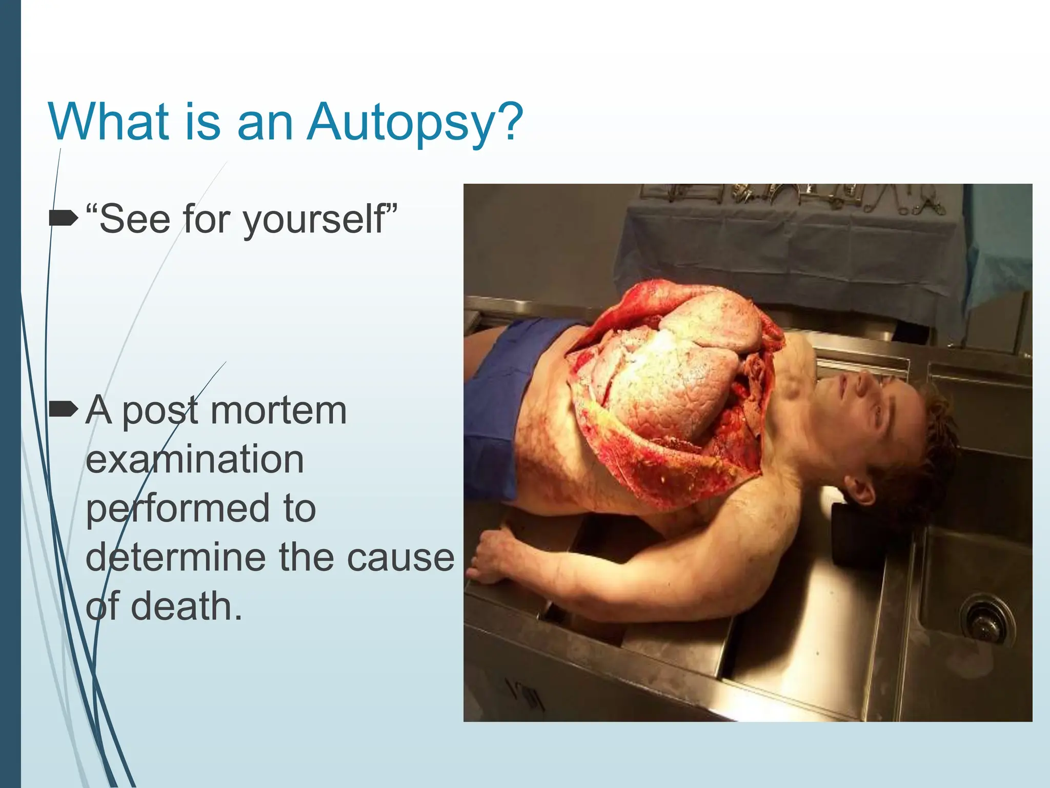 All about Autopsy in forensic medicine .pptx