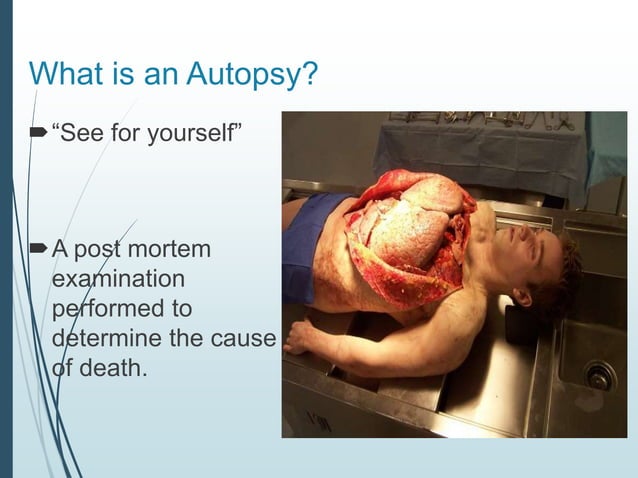 All about Autopsy in forensic medicine .pptx | Death, Injury, or ...
