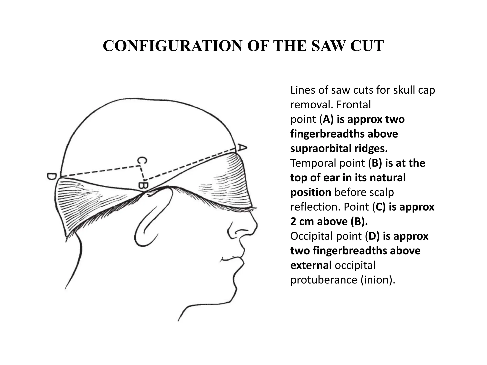 Autopsy-of-brain.pptx