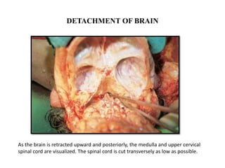 Autopsy-of-brain.pptx