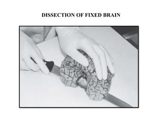 Autopsy-of-brain.pptx