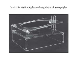 Autopsy-of-brain.pptx