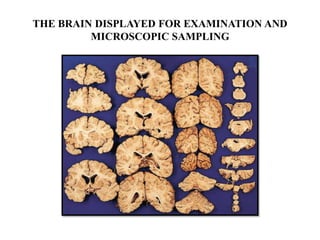 Autopsy-of-brain.pptx