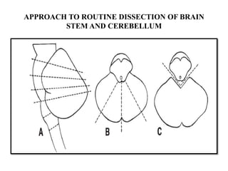 Autopsy-of-brain.pptx