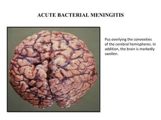 Autopsy-of-brain.pptx