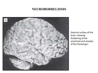 Autopsy-of-brain.pptx