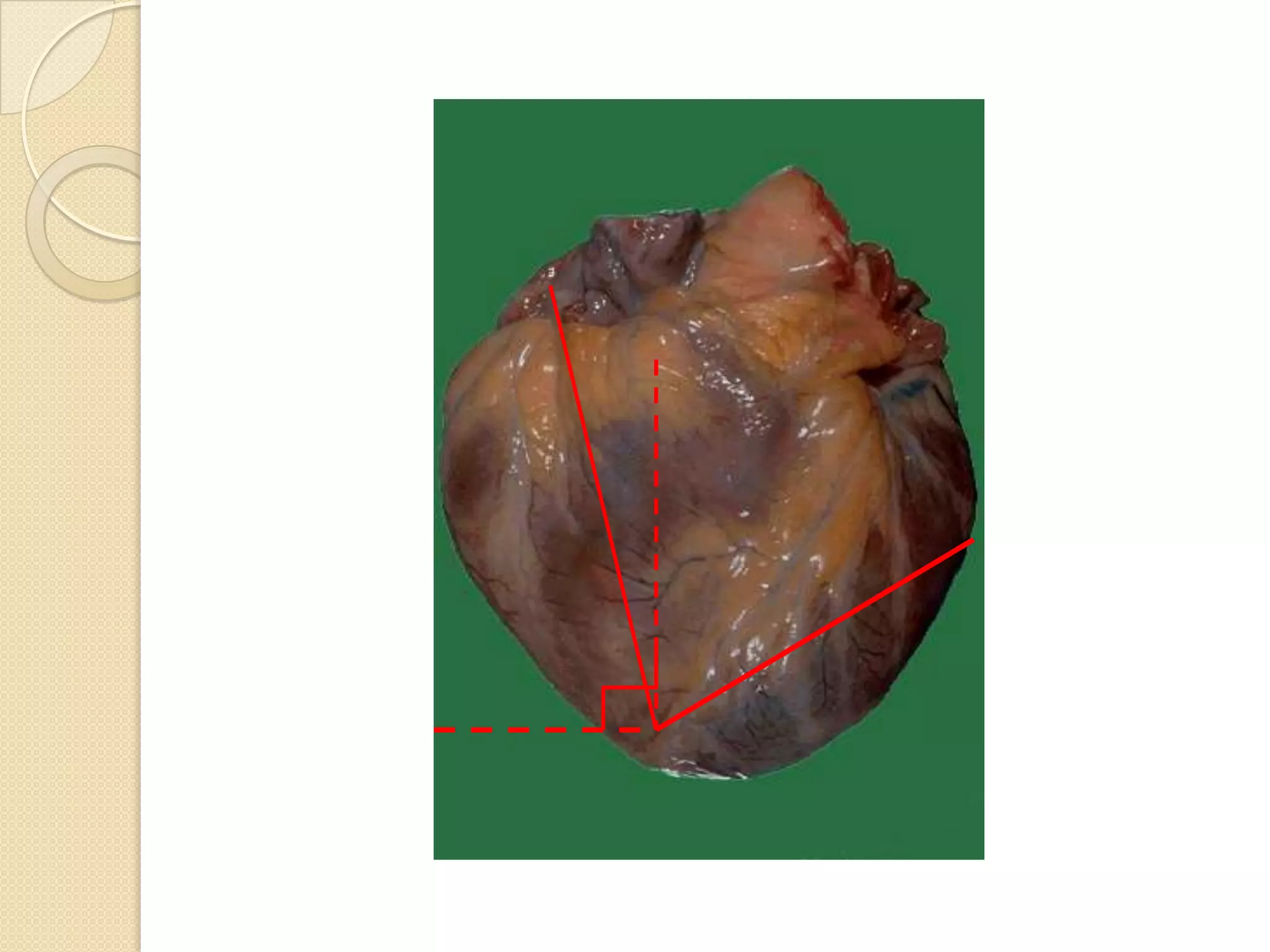 Autopsy dissection of heart and spinal cord | PPTX