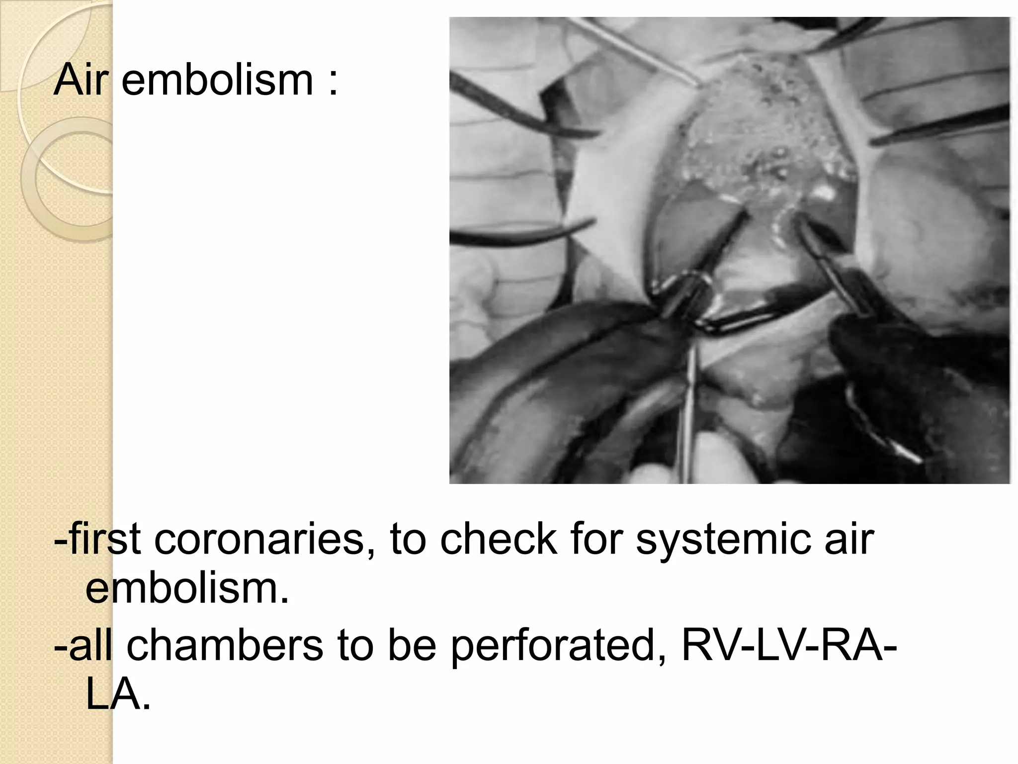 Autopsy dissection of heart and spinal cord | PPTX