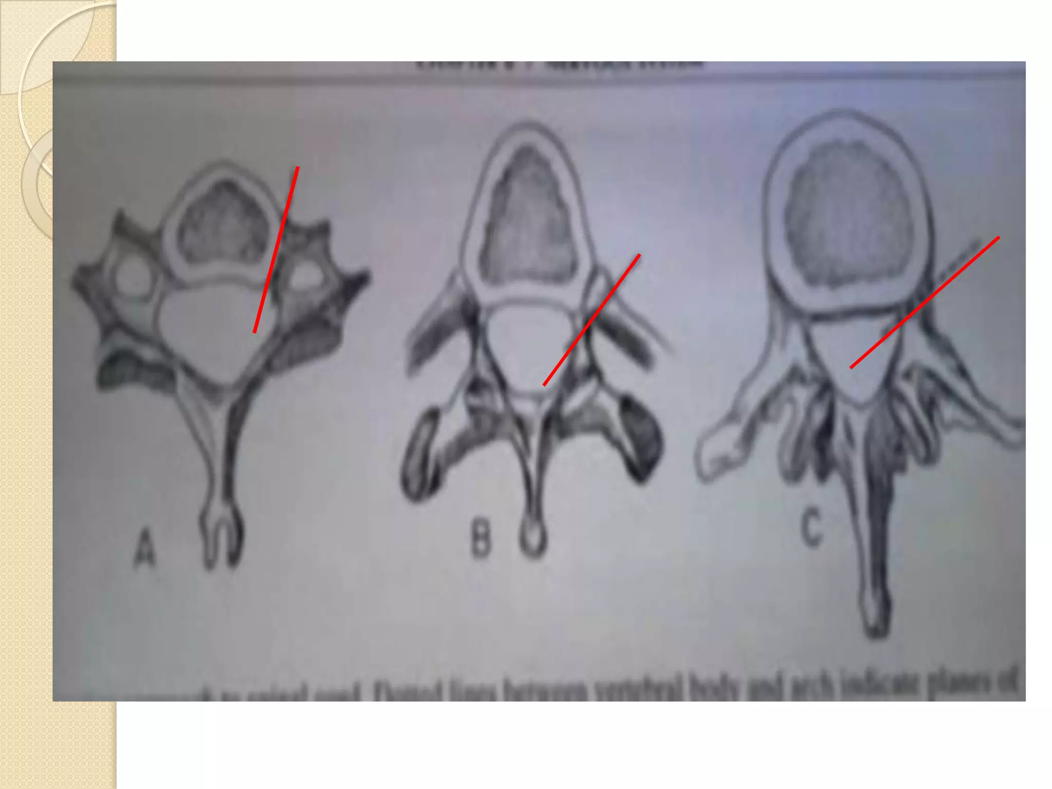Autopsy dissection of heart and spinal cord | PPTX