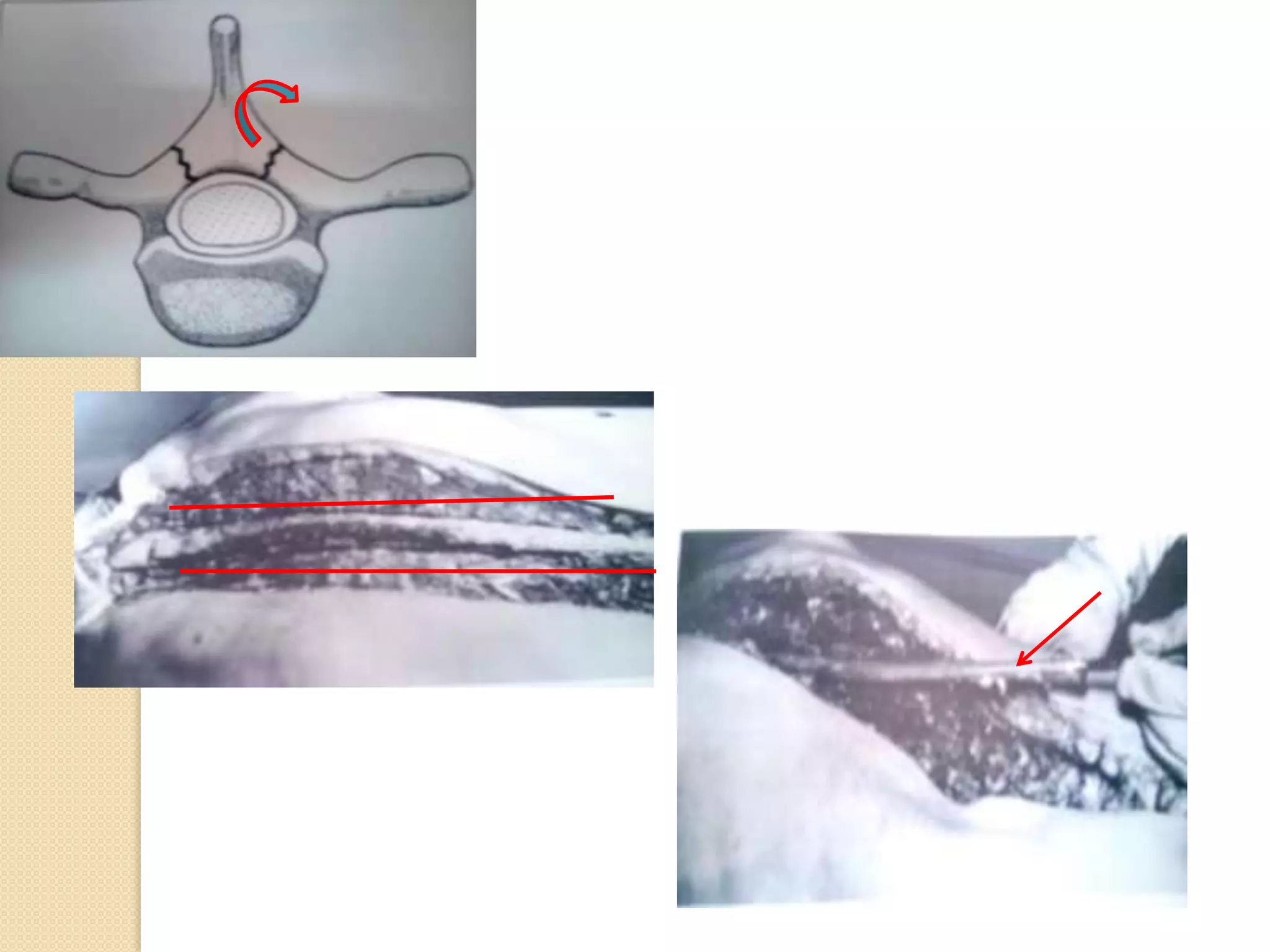 Autopsy dissection of heart and spinal cord | PPTX