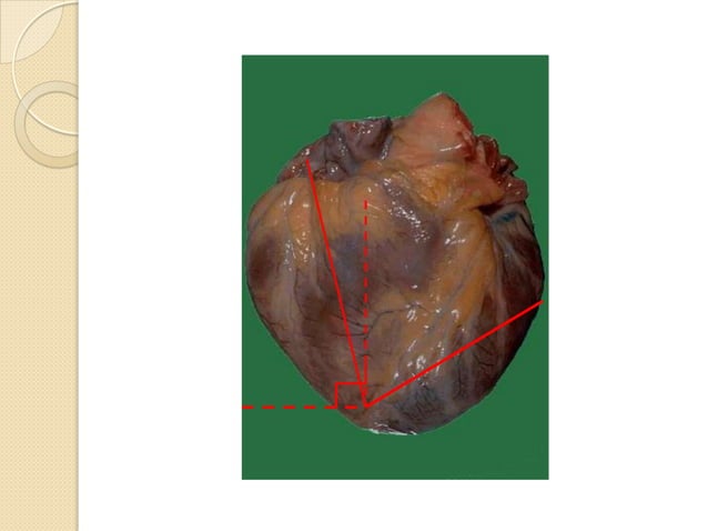 Autopsy dissection of heart and spinal cord | PPTX