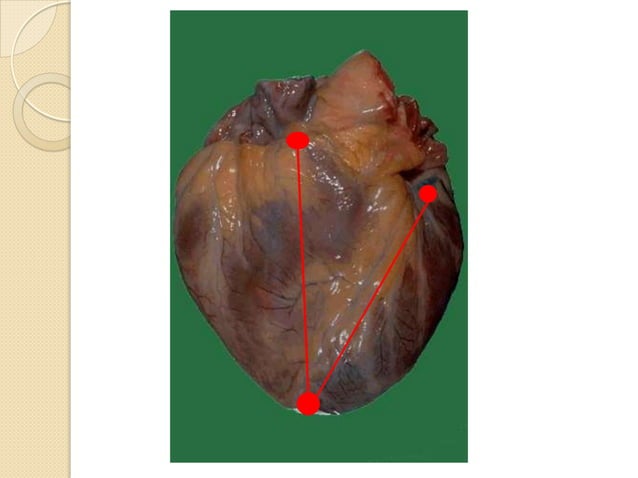 Autopsy dissection of heart and spinal cord | PPTX