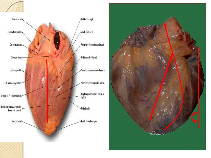Autopsy Dissection Of Heart And Spinal Cord